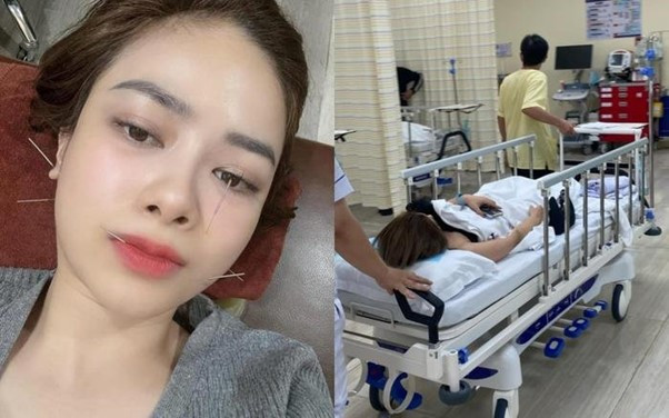 Dương Hoàng Yến đau đớn khi điều trị châm cứu, sau bị liệt dây thần kinh số 7