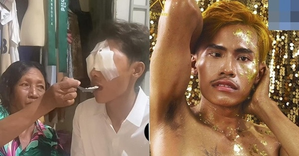 Lai Thai thí sinh hot nhất Nam vương Campuchia tiếp tục thẩm mỹ mắt gây sốc
