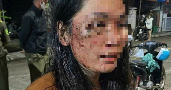 Nữ shipper tố bị khách hàng hành hung